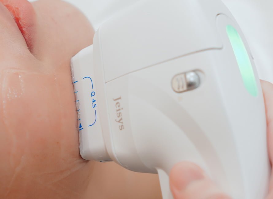 Why Choose V Medical Aesthetic HIFU $550 - V Medical Aesthetics & Laser ...
