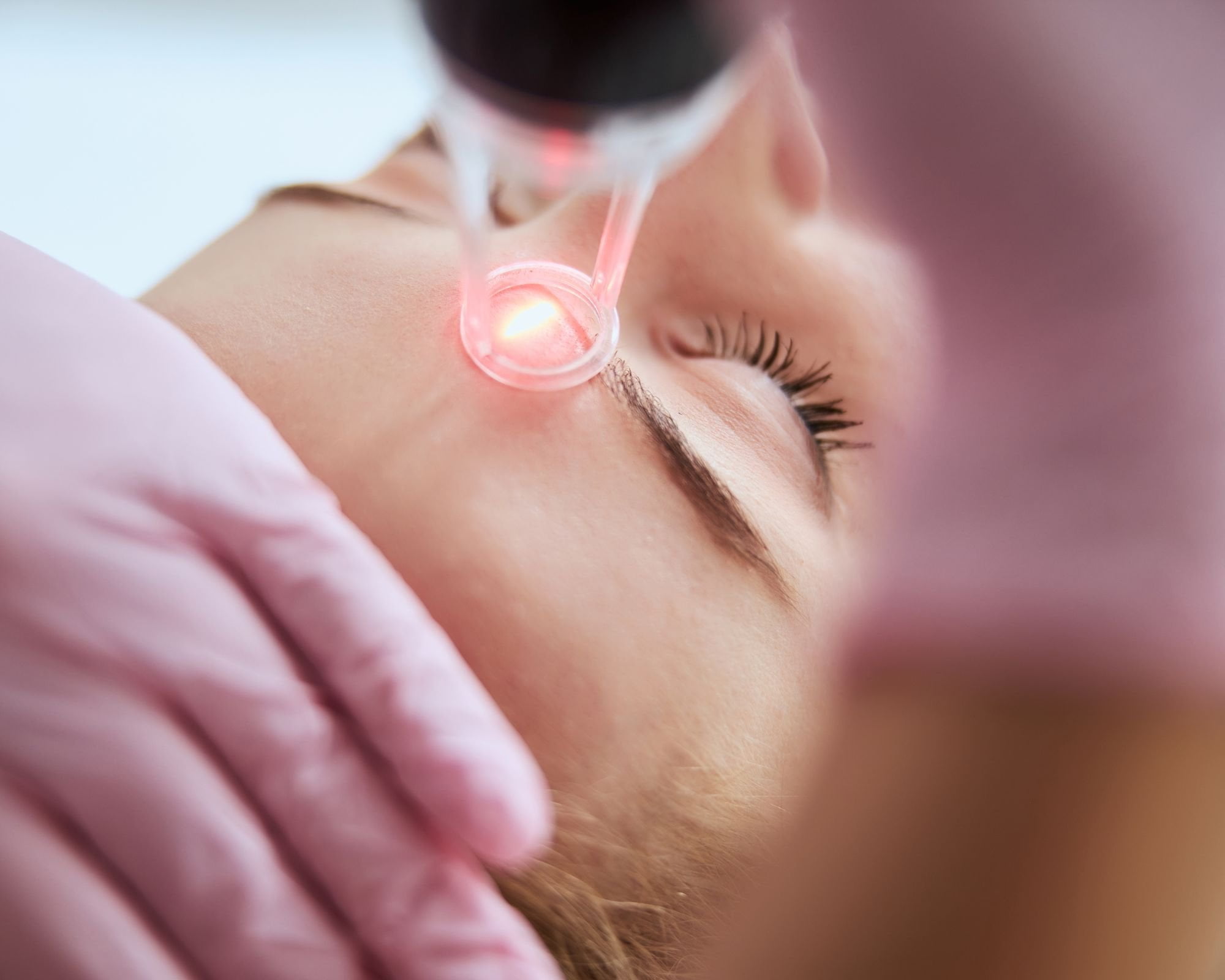 3 Common Side Effects of Pico Laser Treatment Explained